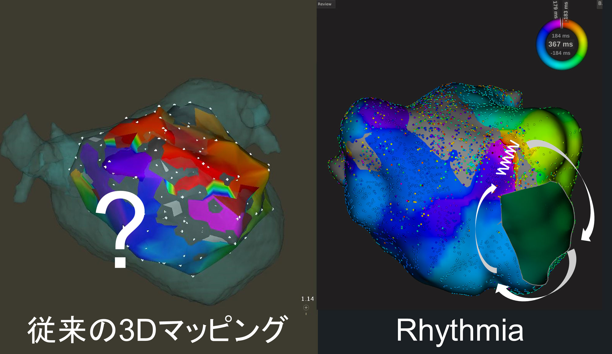 rhythmia_2017 | 関西ろうさい病院（兵庫県尼崎市）地域医療支援病院・がん診療連携拠点病院
